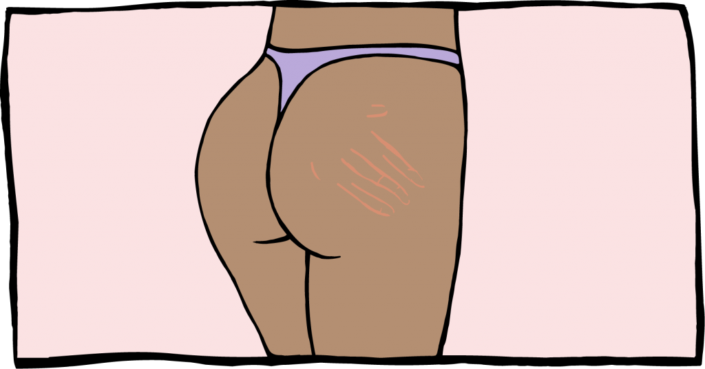 Normal And Abnormal Sex — Nvsh Everything About Sexuality